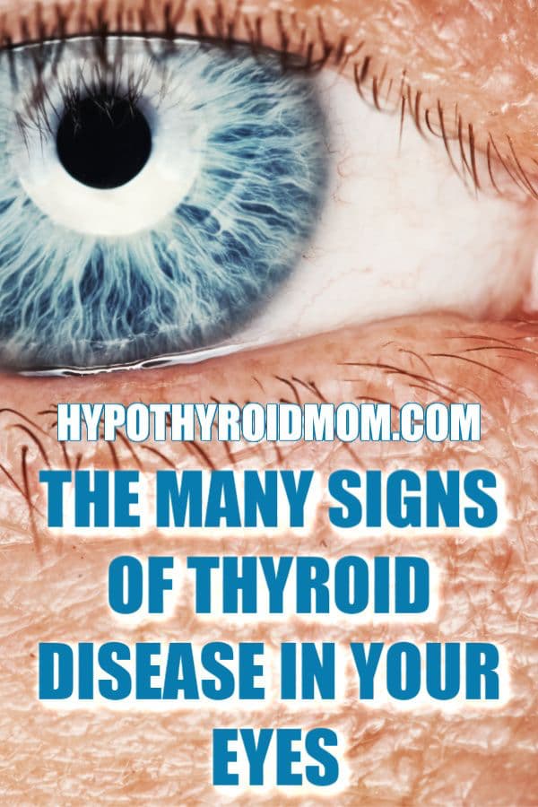 MOST HELPFUL THYROID POSTS - Hypothyroid Mom