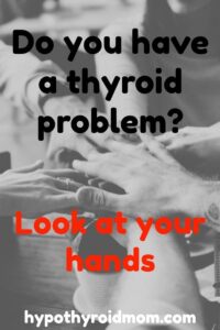 Thyroid And The Extremities (Hands, Arms, Legs & Feet) - Hypothyroid Mom