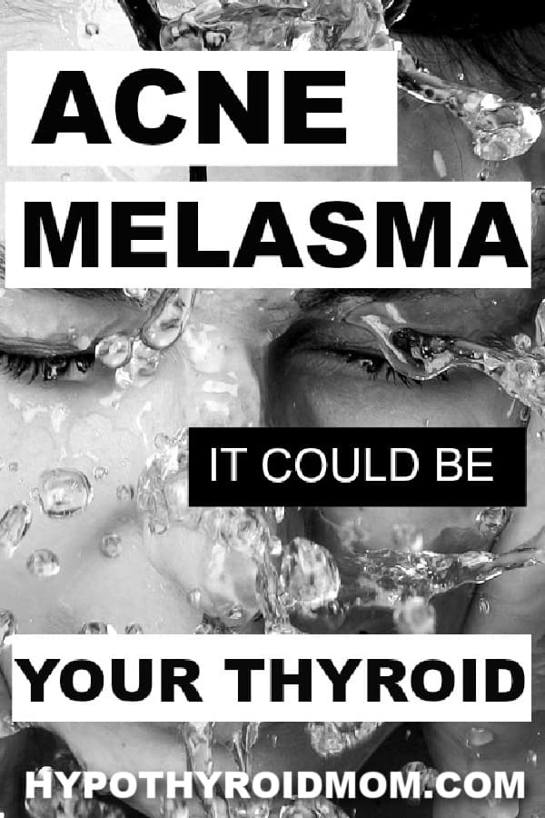 Thyroid Hair, Skin & Nails | Hypothyroid Mom