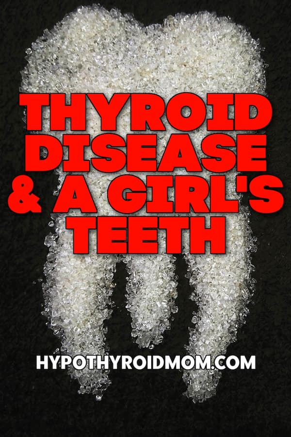 Thyroid Mouth, Teeth, Tongue, And Throat | Hypothyroid Mom